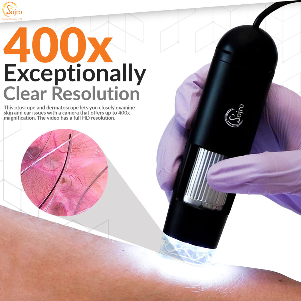 Tech4Life Oto-Dermascope: Advanced Digital Otoscope & Dermascope for ...
