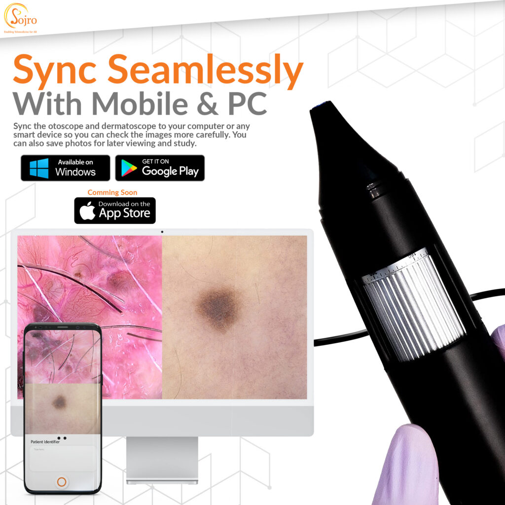 Tech4Life Oto-Dermascope: Advanced Digital Otoscope & Dermascope for ...